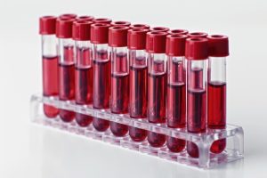 Exploring Capillary Tubes for Blood Collection: Design and ...