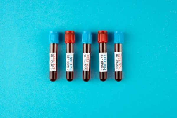 The Role of Sodium Heparin Blood Collection Tubes in Clinical Chemistry ...